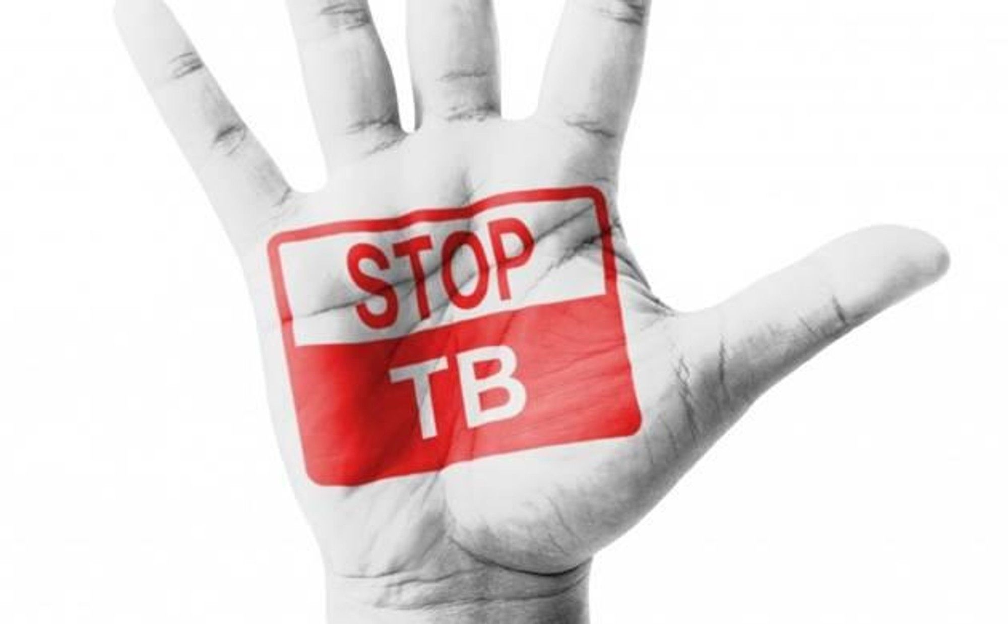 New vaccine trial brings hope in the fight against tuberculosis on World TB Day