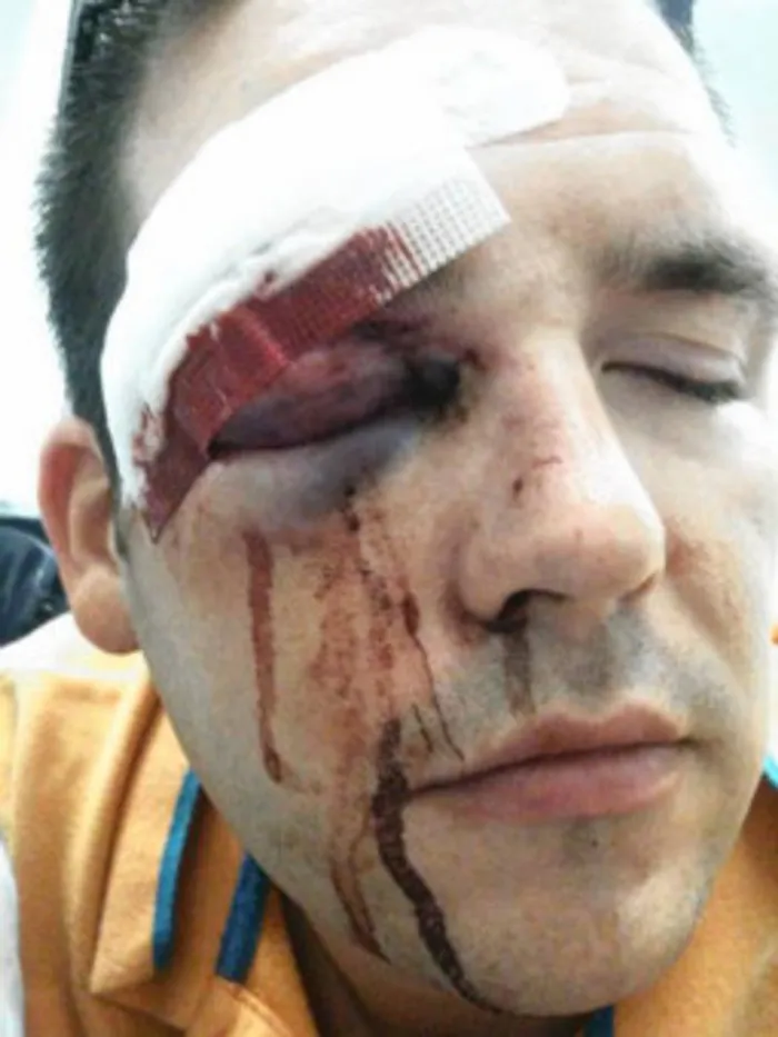 Foreigner hit by stone to sue Metrorail