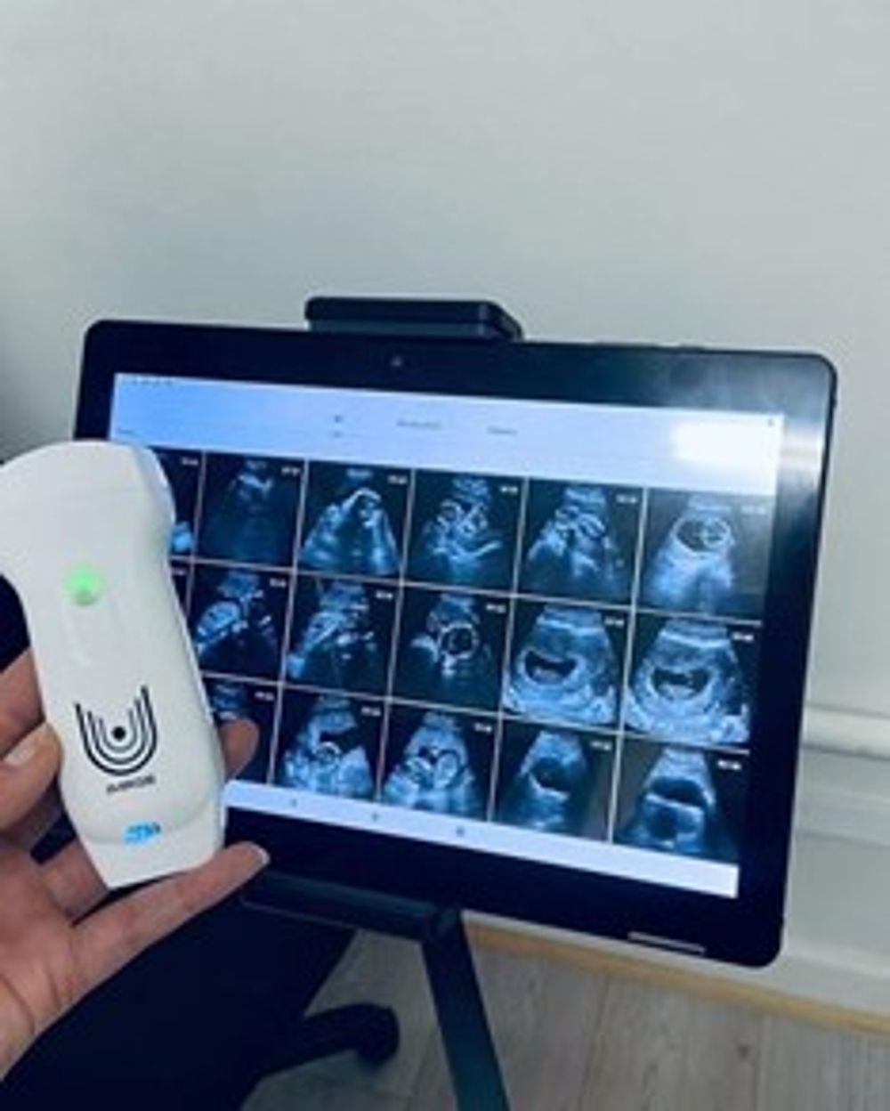 SA medical tech company rolls out innovative wireless ultrasound solution