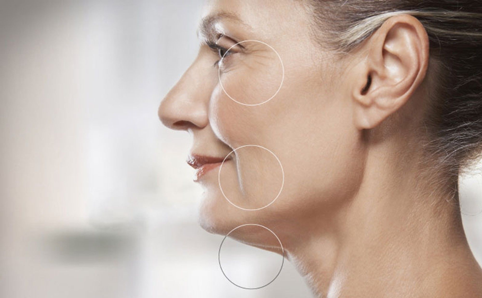 An in-depth look at Botox, fillers and threads