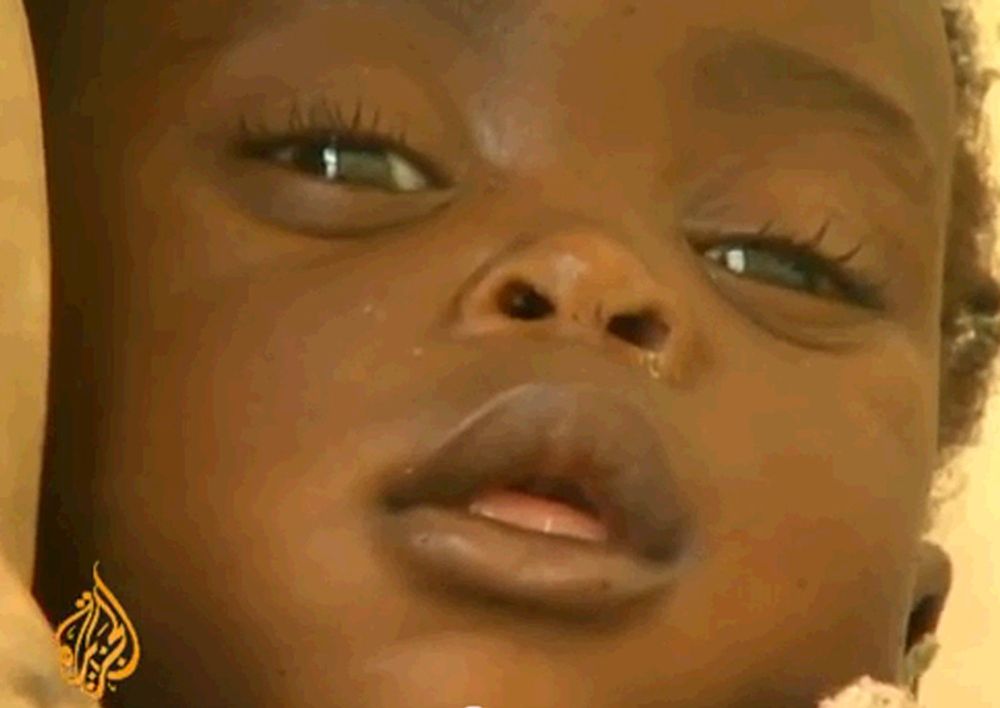 SL needs funding for cholera fight