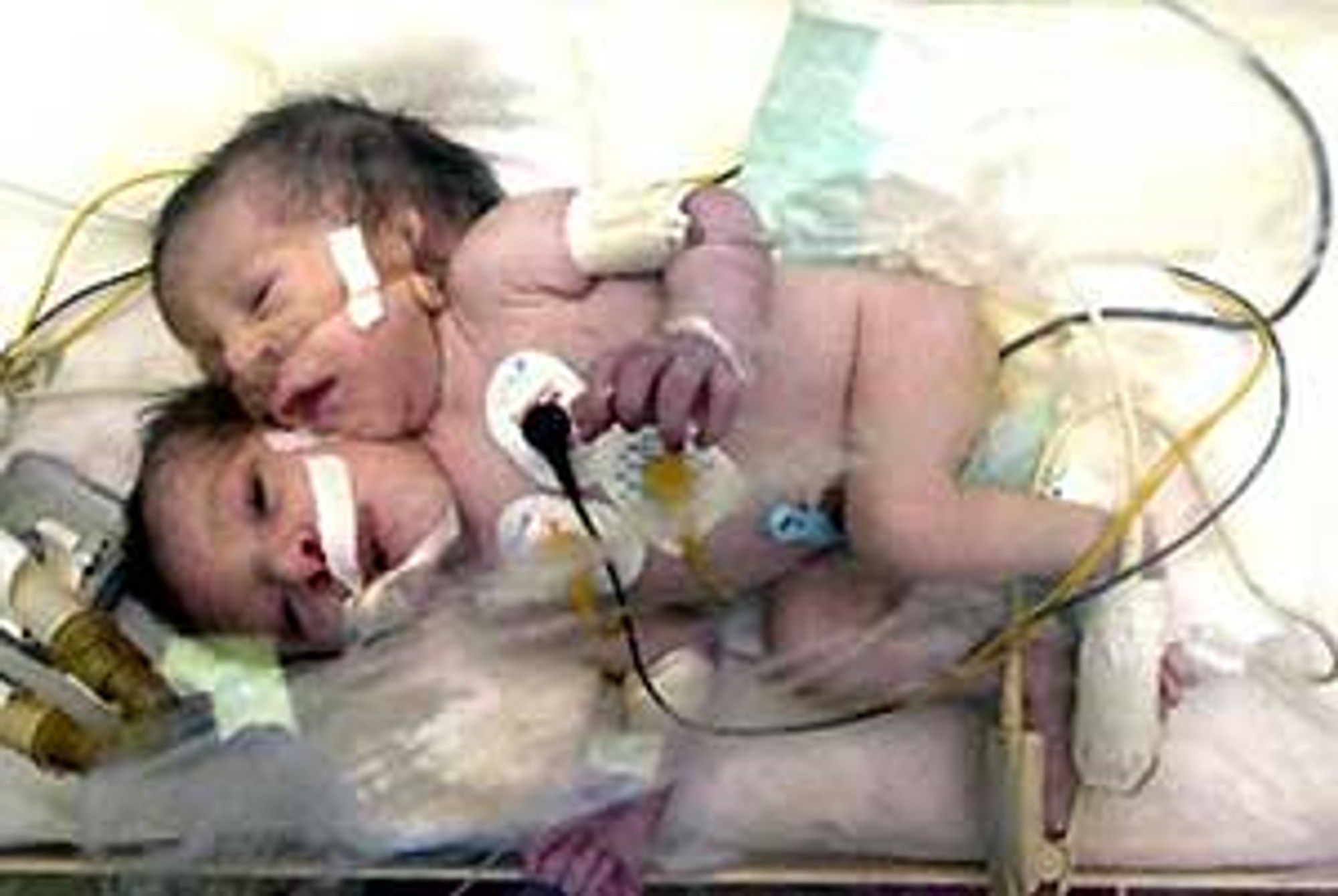 Egyptian mummy gives birth to two-headed girl