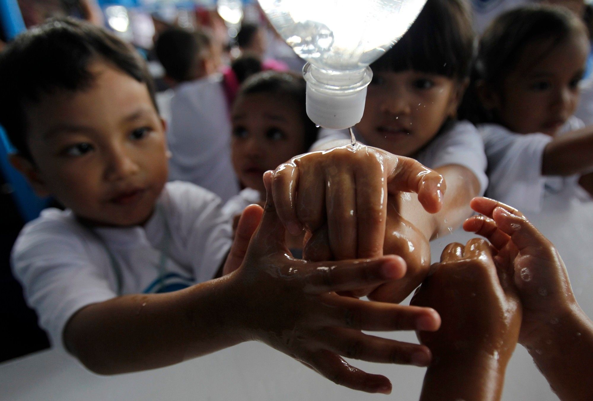 How poor hygiene affects children in South Africa
