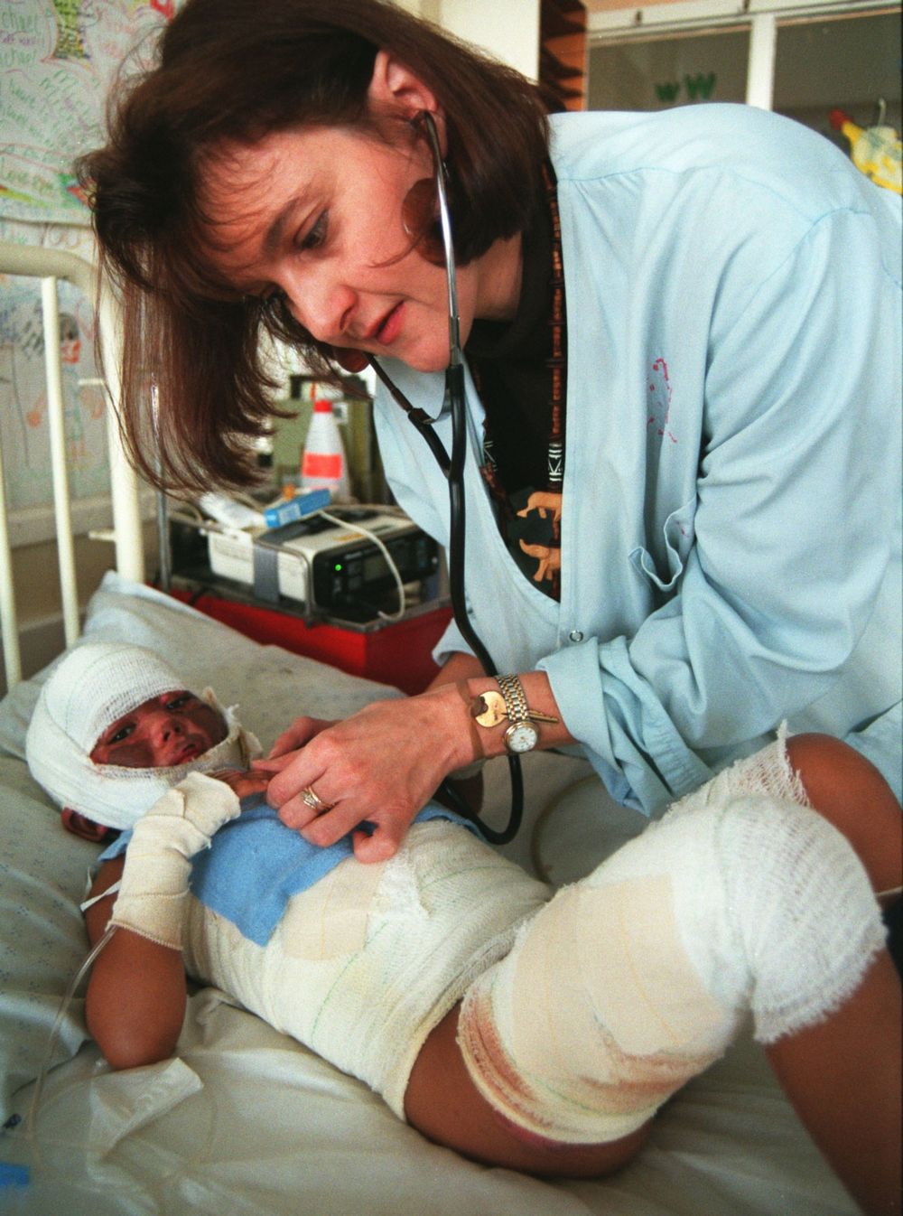 Concerns of increased cases of children burning as winter approaches