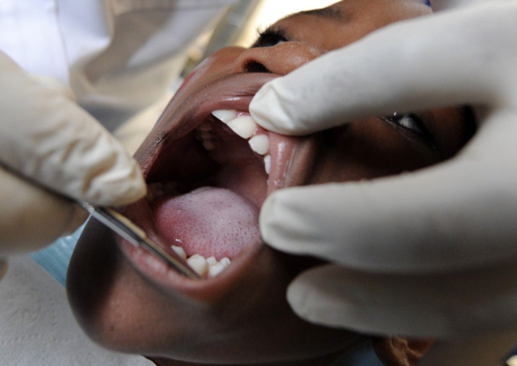 Wonky teeth could leave you unbalanced