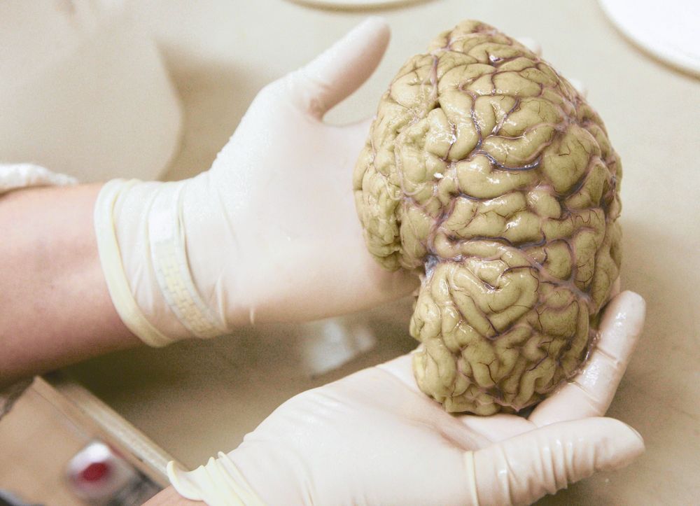 Mentally demanding jobs may lower dementia risk
