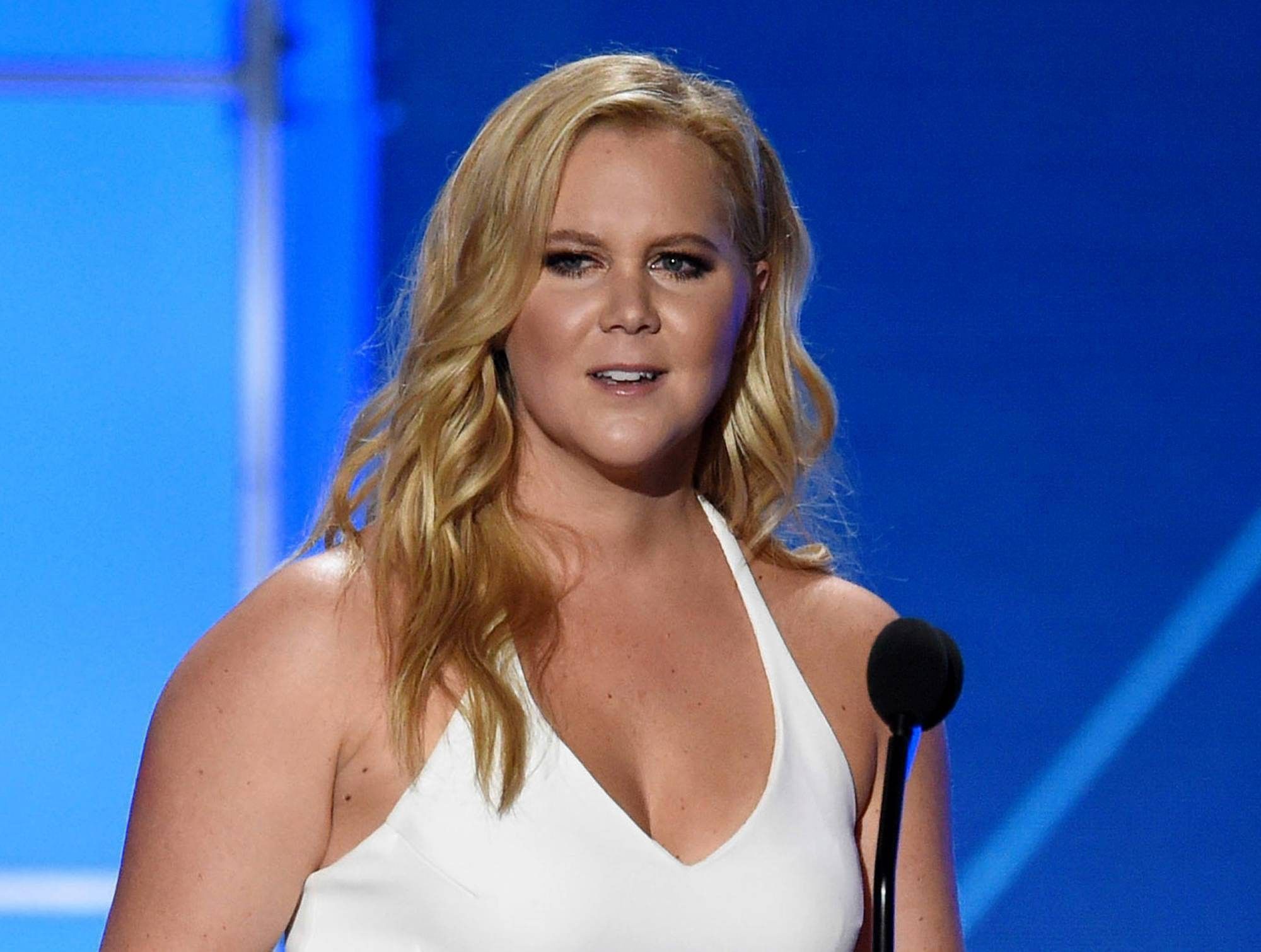 Amy Schumer had her cheek derma fillers dissolved because she ’looked ...