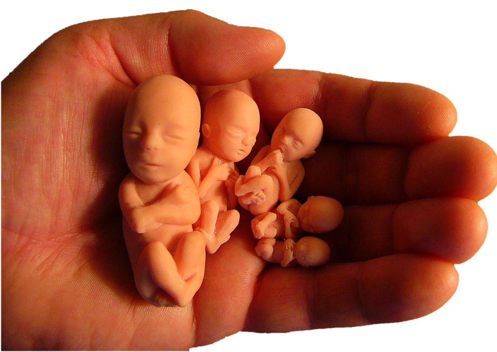 Decline in US abortion rate slows