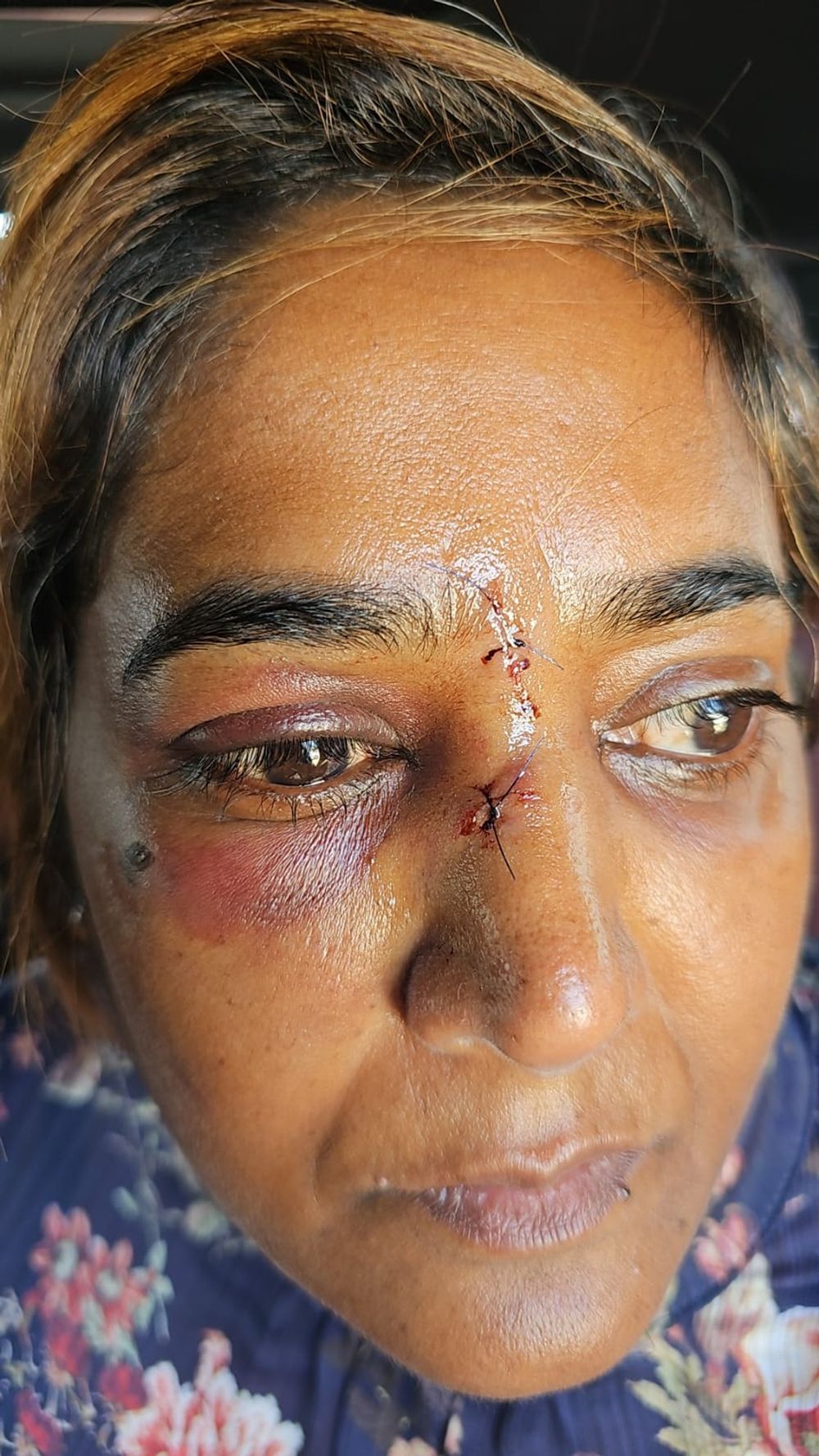 Ballito businesswoman awaits justice as police officer assault trial begins