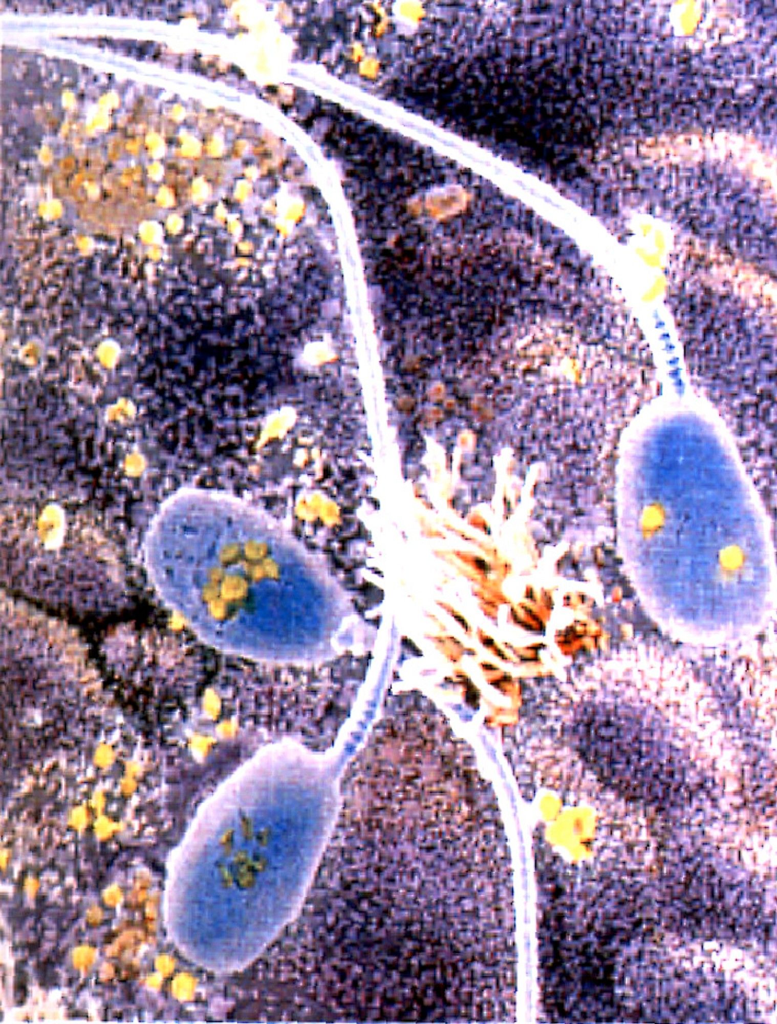 Izinkinga zenzalo zidala ingcindezi emadodeni