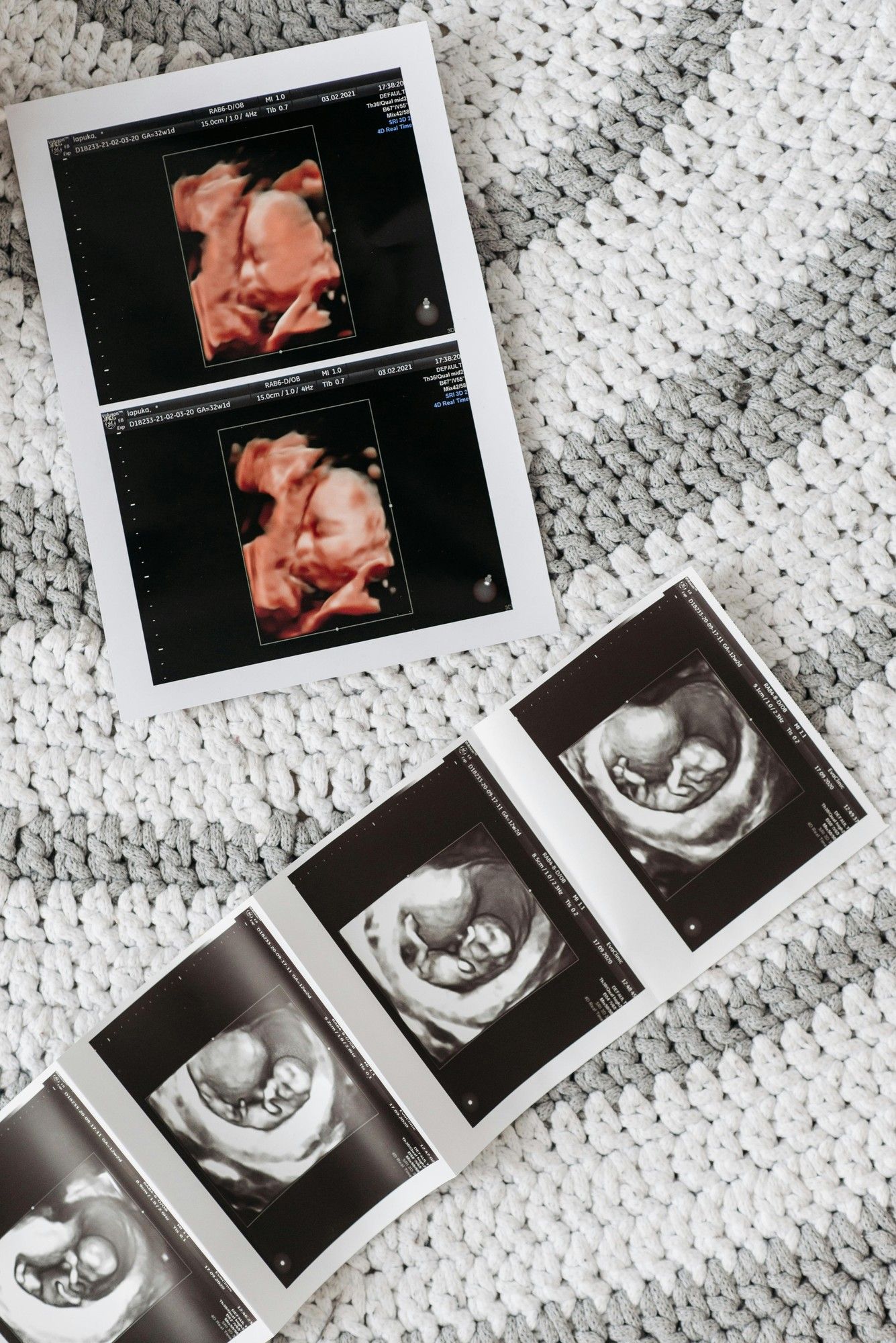 Specialist shares insights on fetal MRI and how it improves neonatal ...