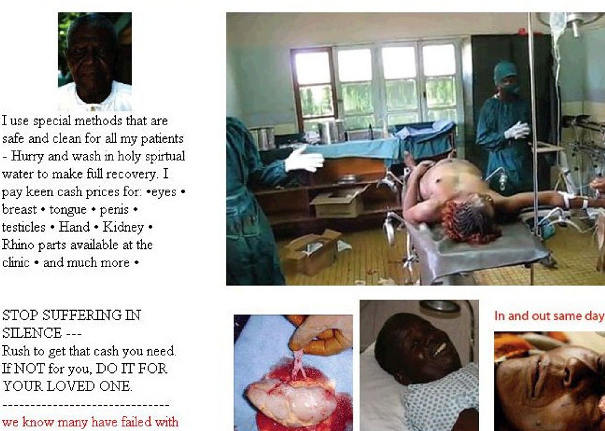 Agency apologises for 'body parts' ad