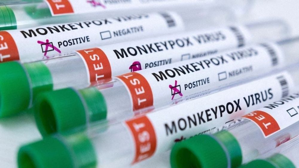 Mpox under control in Western Cape despite second case, health ...