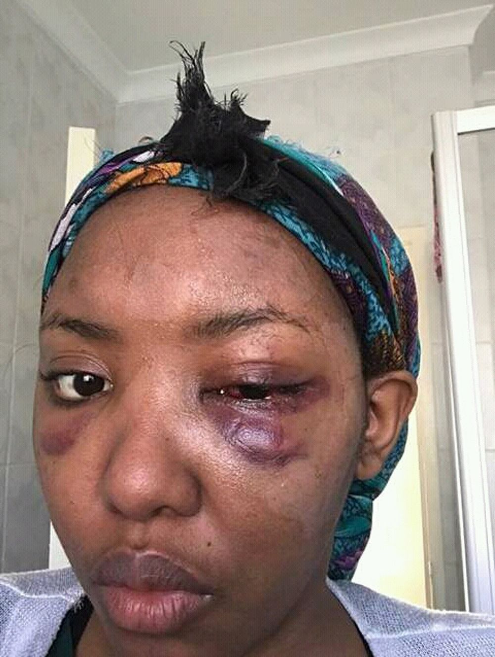 Woman beaten up over a parking spot