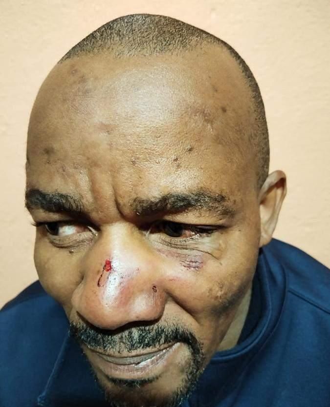 Sol Plaatje University rugby rocked by assault charges