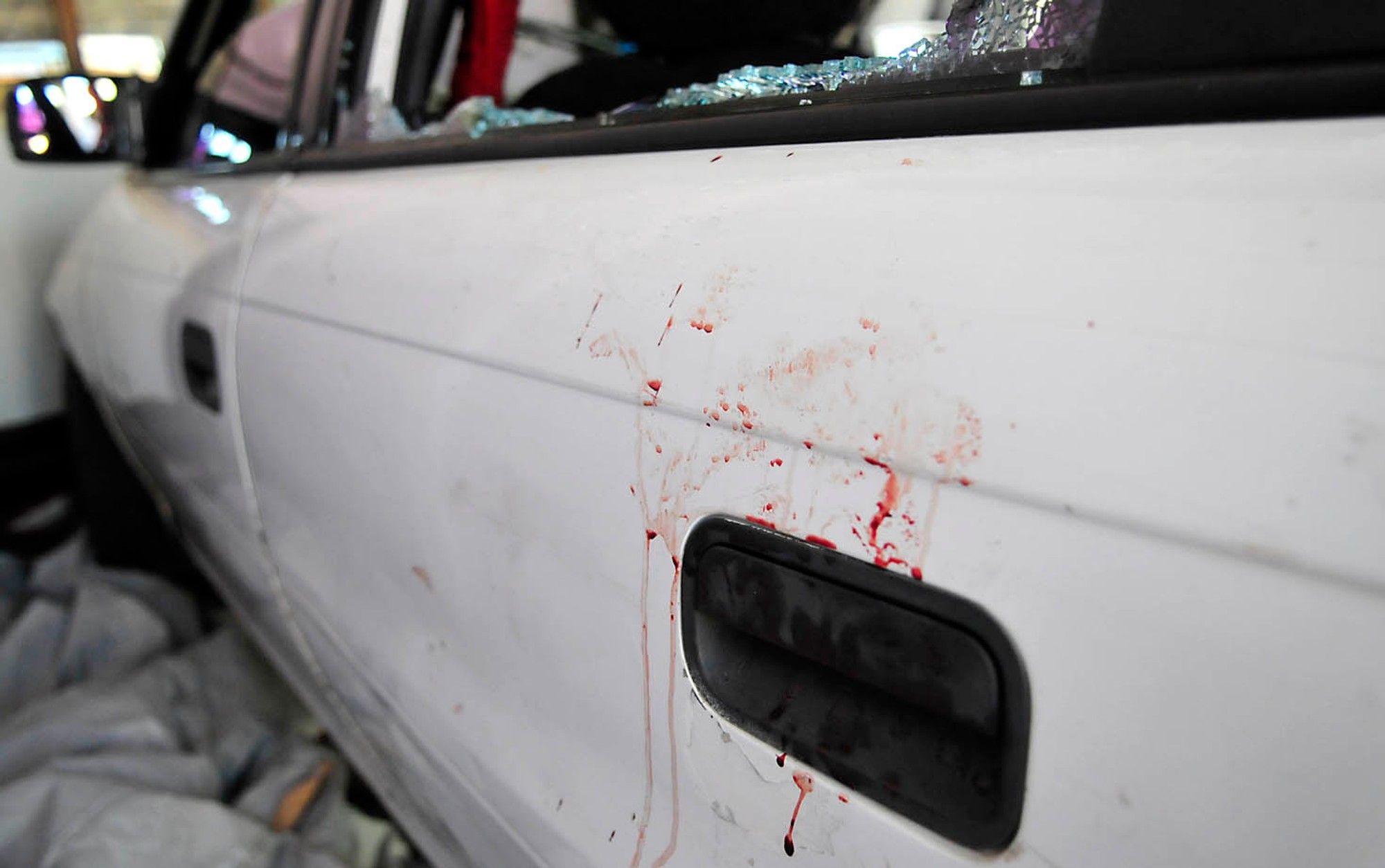 Drive-by victim loses fingers