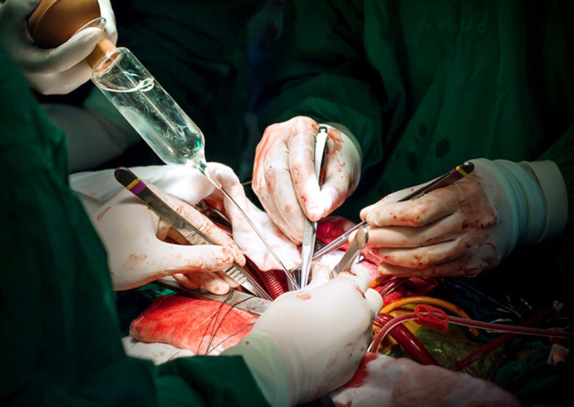 Wrong patient gets heart op