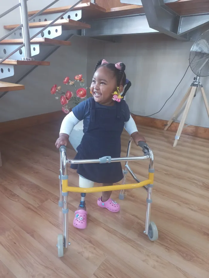 Joy as Leah-Rose, 2, takes first steps on prosthetic leg