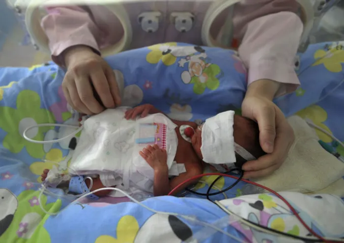 Steroids help very young babies survive - study