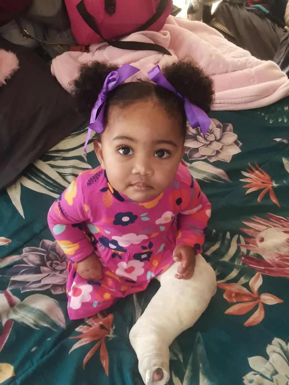 Joy as Leah-Rose, 2, takes first steps on prosthetic leg