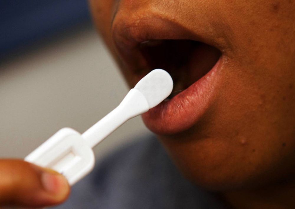 People living longer with HIV - survey