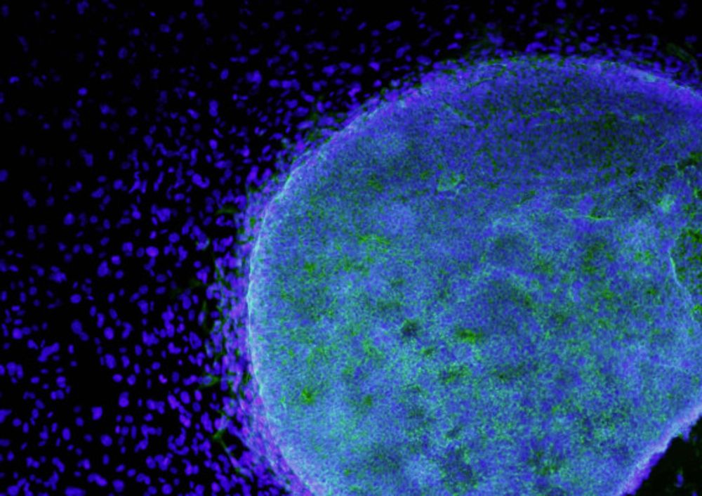 Researchers create liver from stem cells