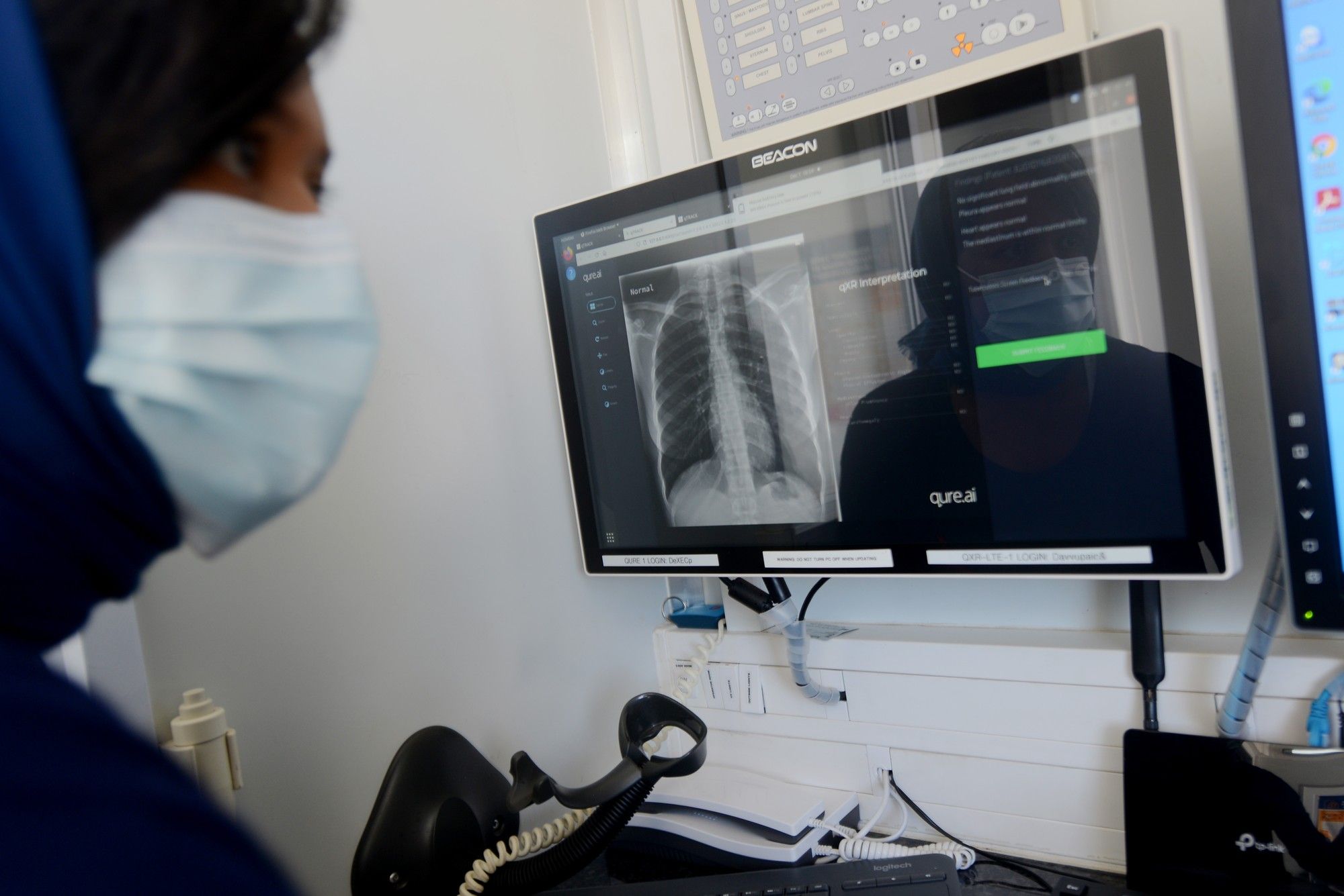 ‘A world without TB is in reach’: South Africa champions a TB-Free ...