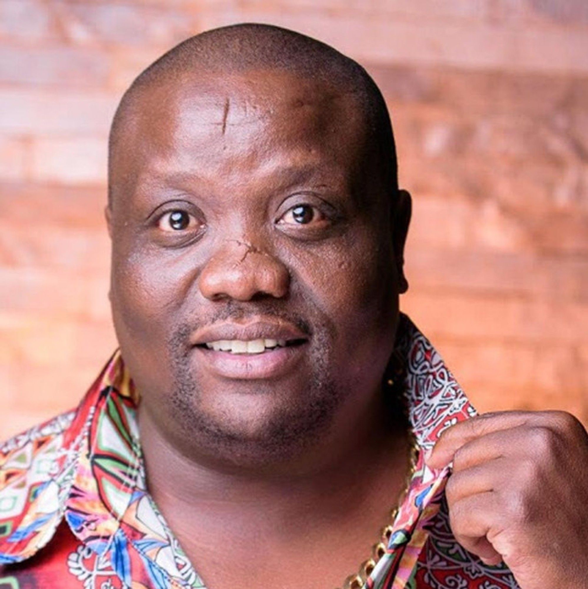 Odokotela basazama ukutotobisa uL’vovo