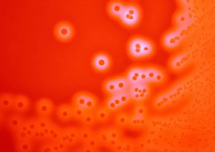 Are your gut bacteria making you sad?