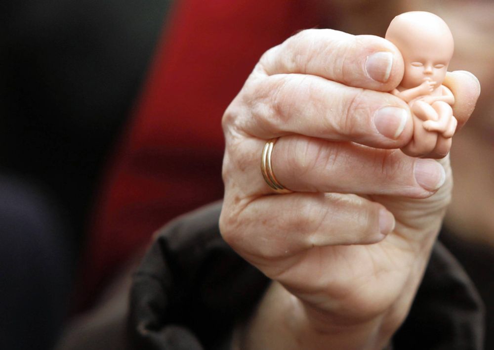 Brazil abortion stirs controversy