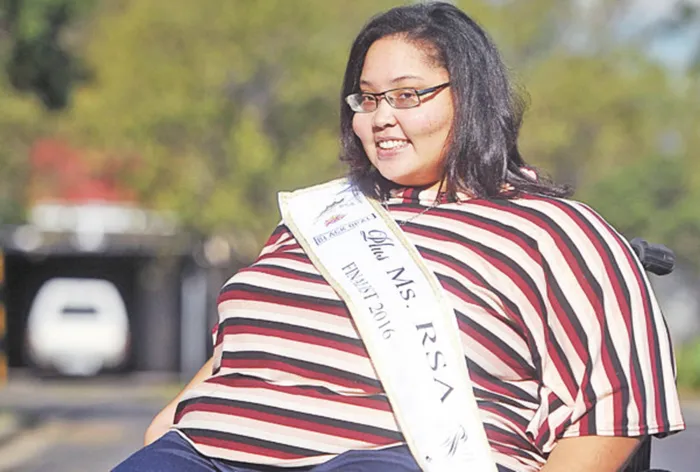 Disability no bar to Plus Ms RSA contestant