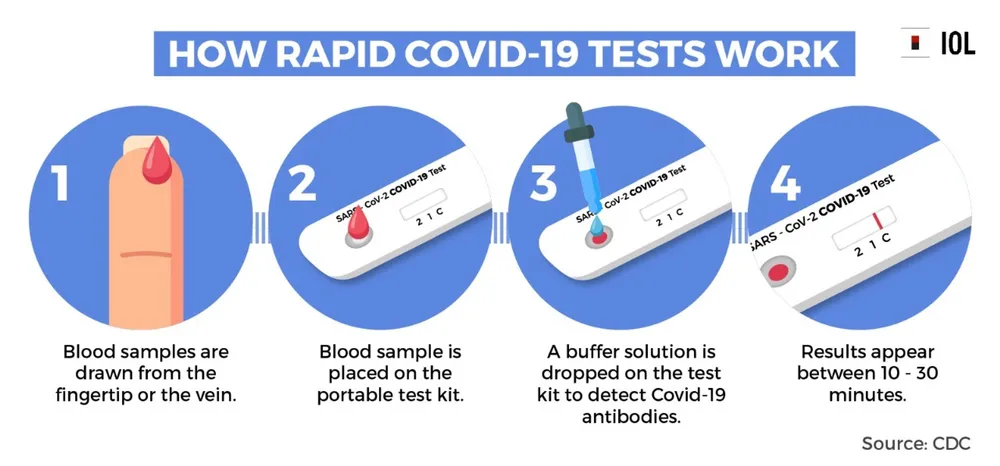 Why rapid Covid-19 testing could be beneficial for SA