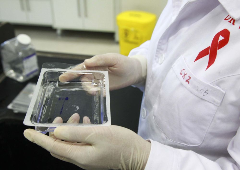 ‘Very far from the end of Aids’