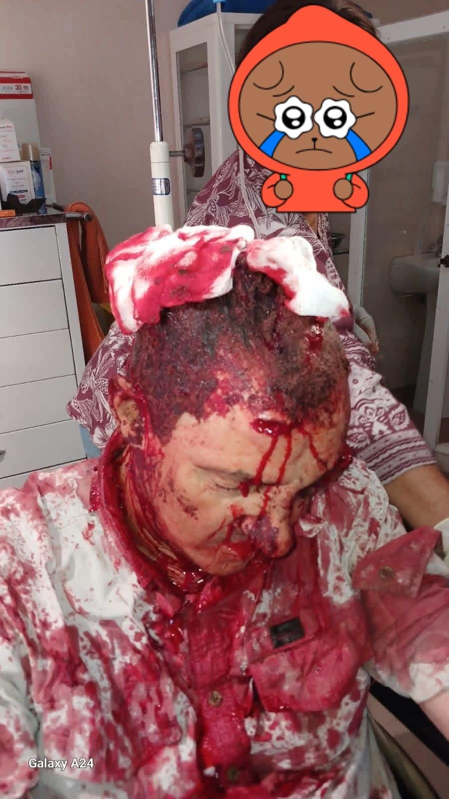 Farmer survives brutal attack by livestock thieves, suffers multiple ...
