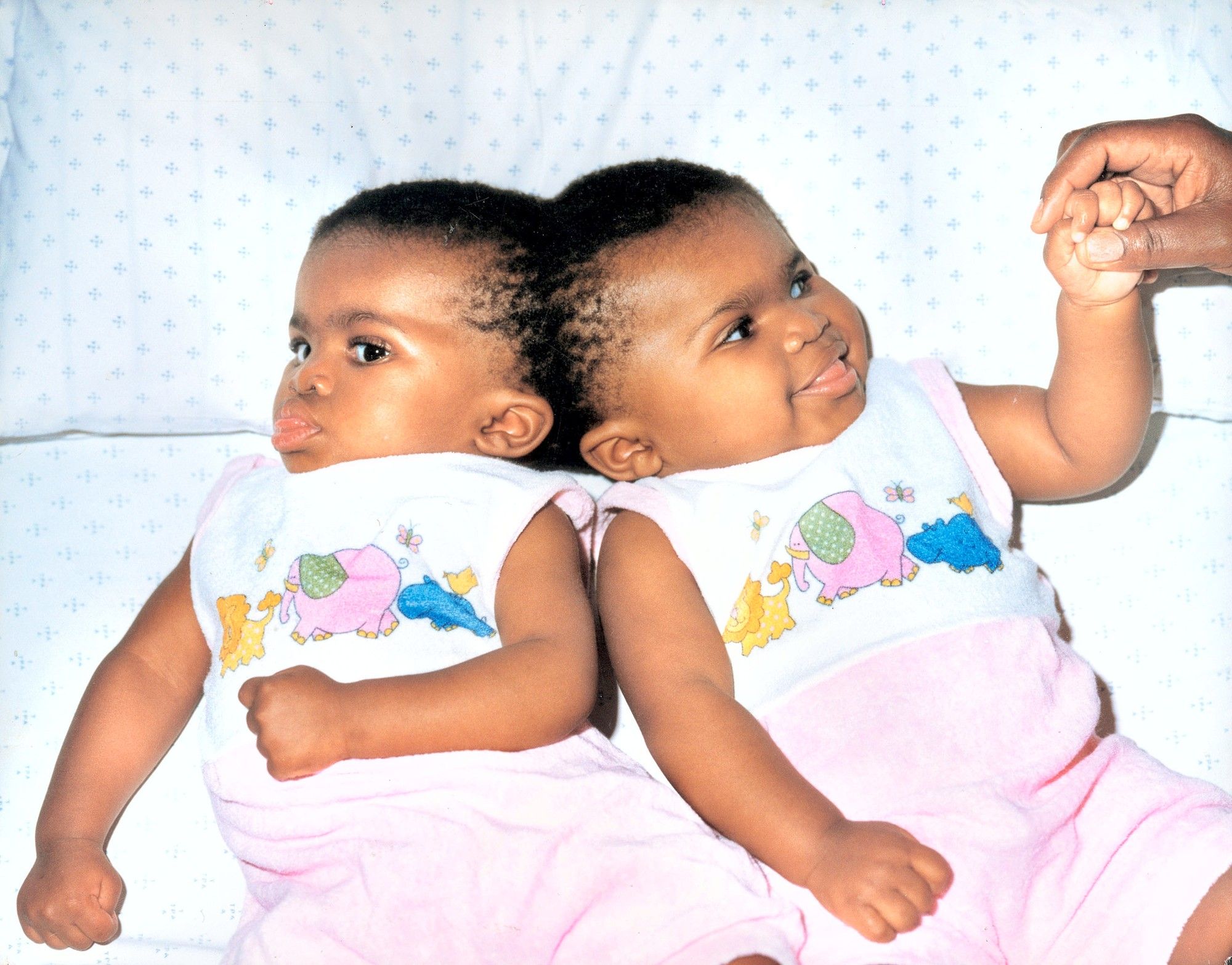 NW premier sends condolences to family of Siamese twin Mpho Mathibela