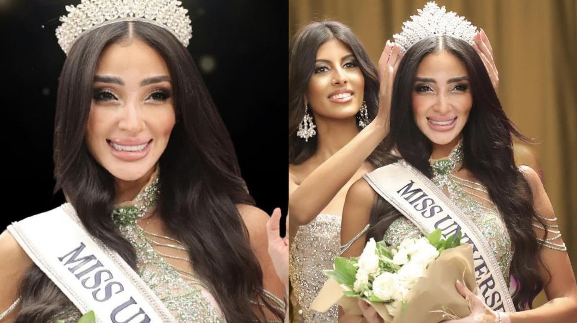 Vitiligo advocate Loginah Salah crowned Miss Universe Egypt 2024