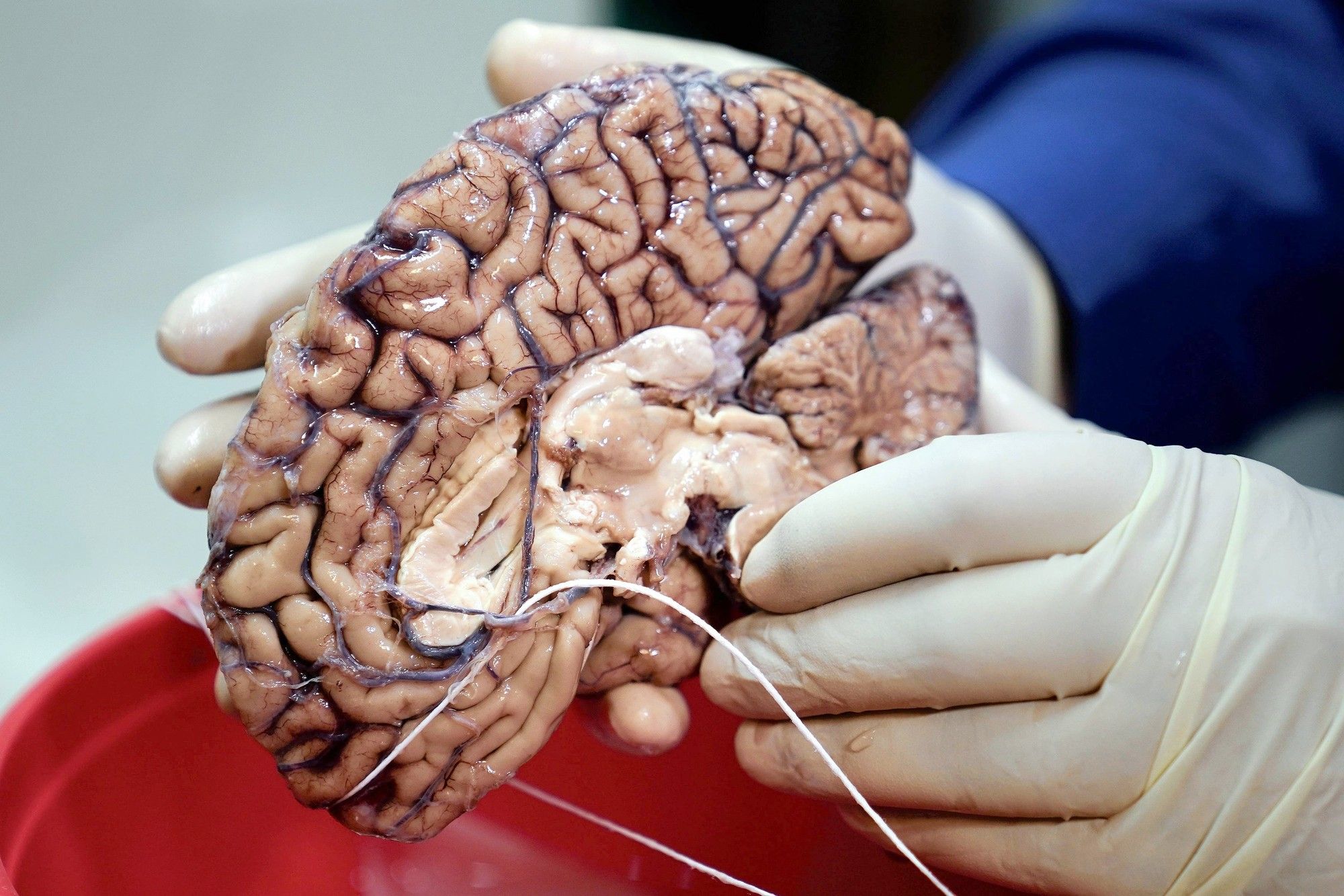 Scientists unveil detailed cell maps of human brain and non-human ...