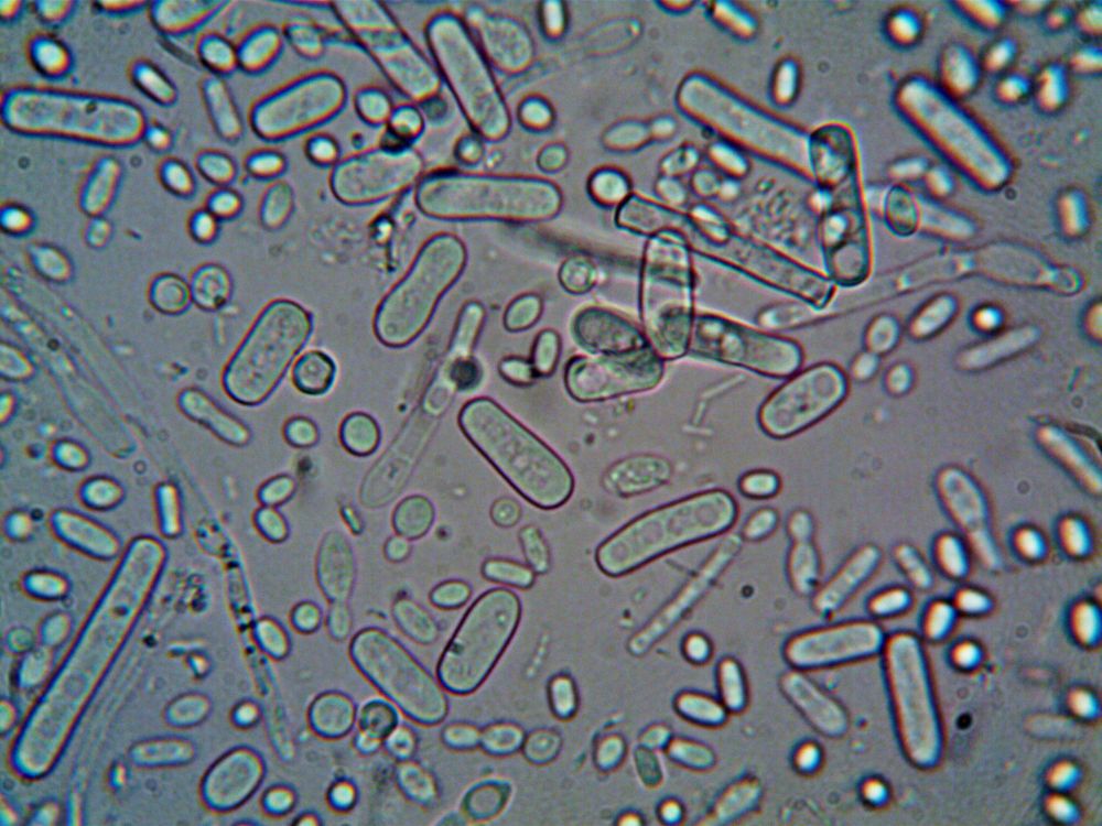 Scientists discover ‘new’ pathogens called ‘zombie viruses’