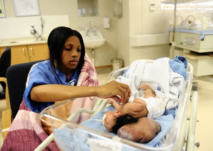 Baby born with brain outside his head