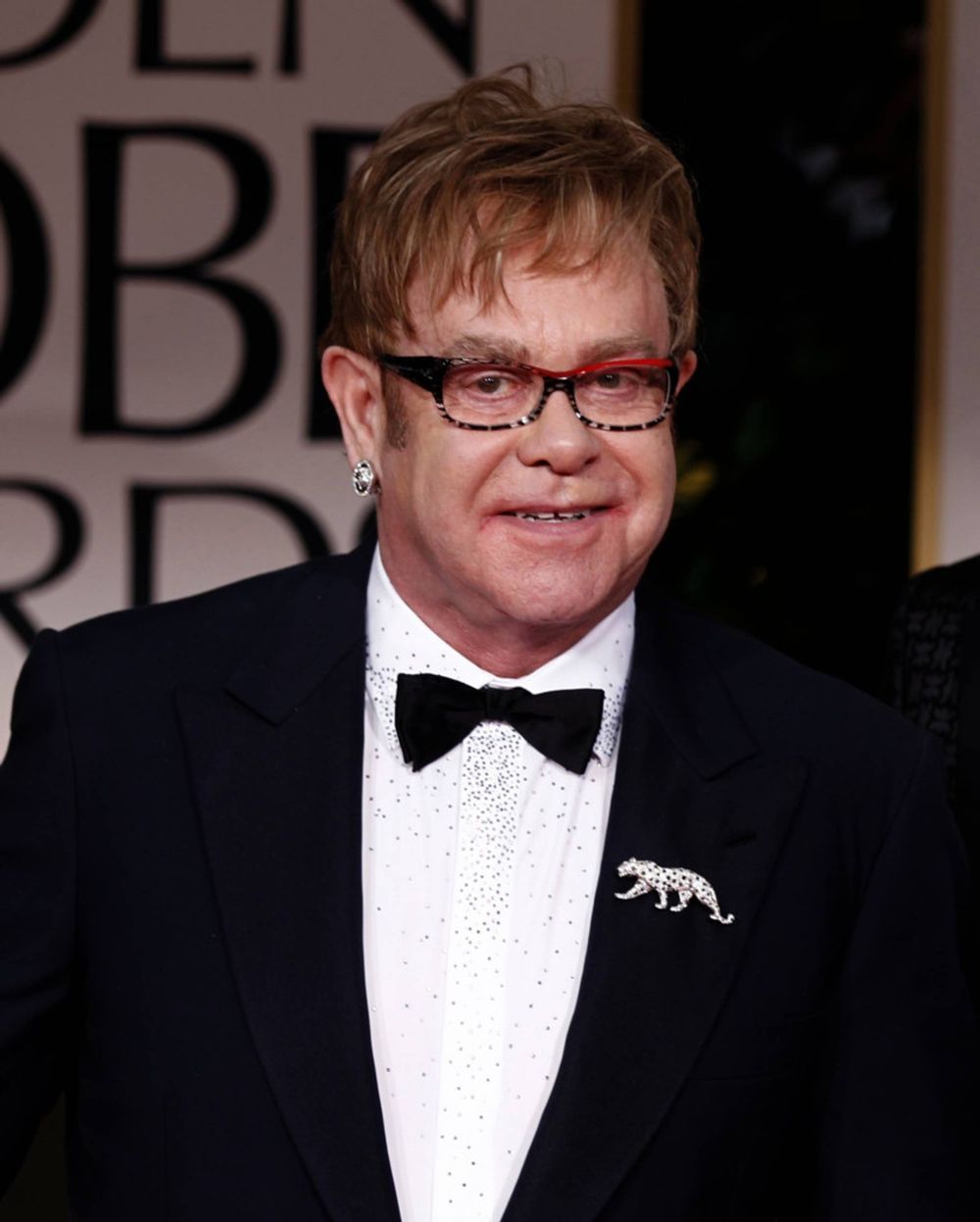 Sir Elton in hospital with ‘serious’ infection
