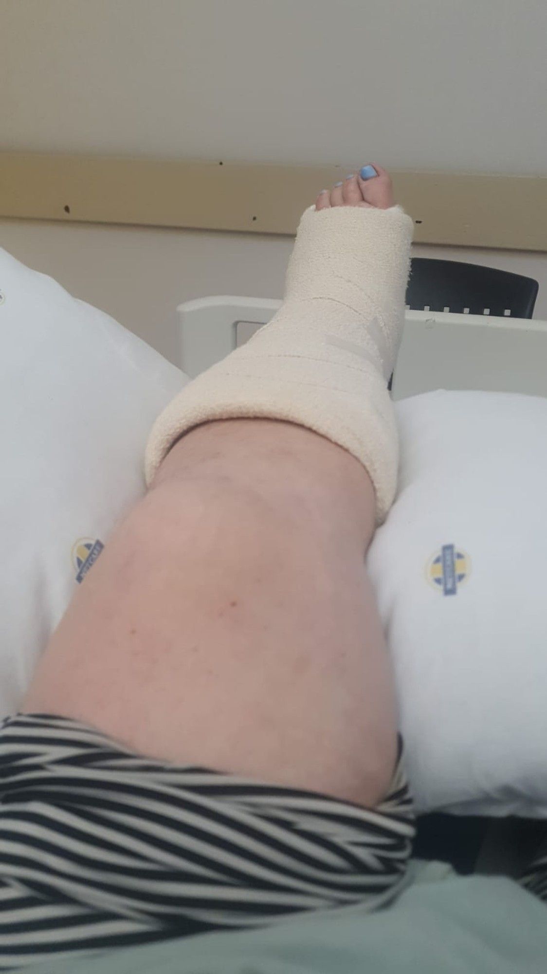 Traffic congestion prevents medics from reaching injured Comrades seconder