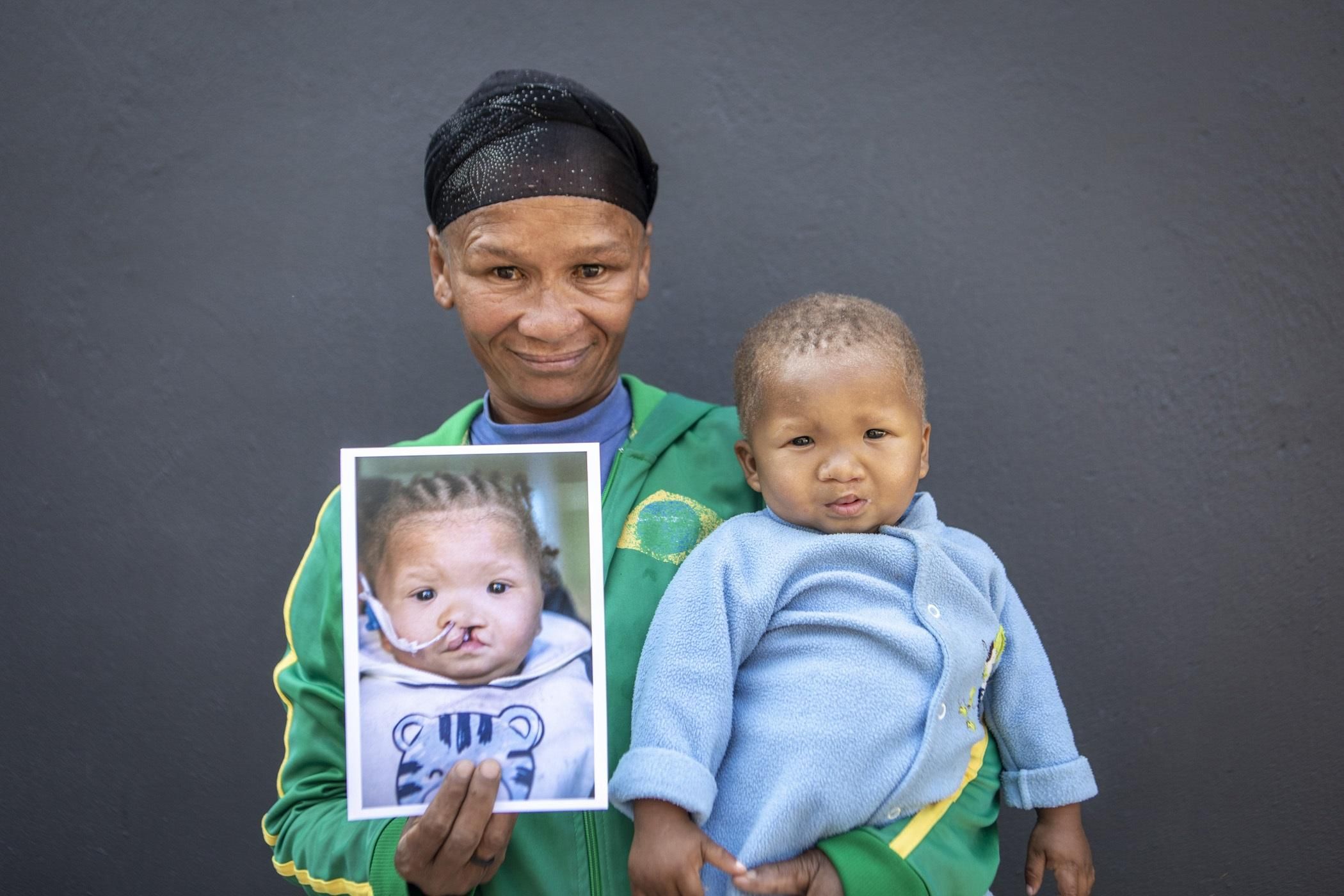 Medical professionals from Gauteng part of Operation Smile’s record ...