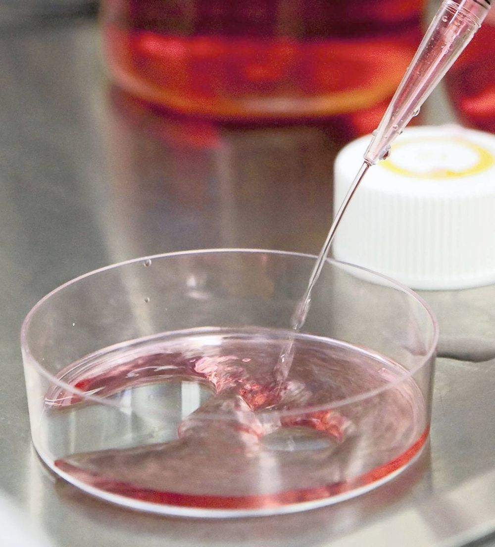 Cancer patient in desperate search for stem cell donor after ex kills ...